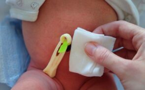 Tout savoir sur le Cordon Ombilical - Fizimed